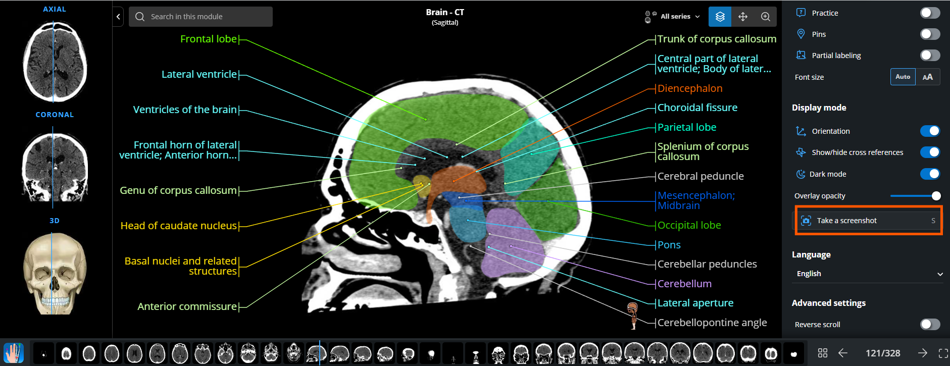 How to save an e-Anatomy image? – IMAIOS Help Center