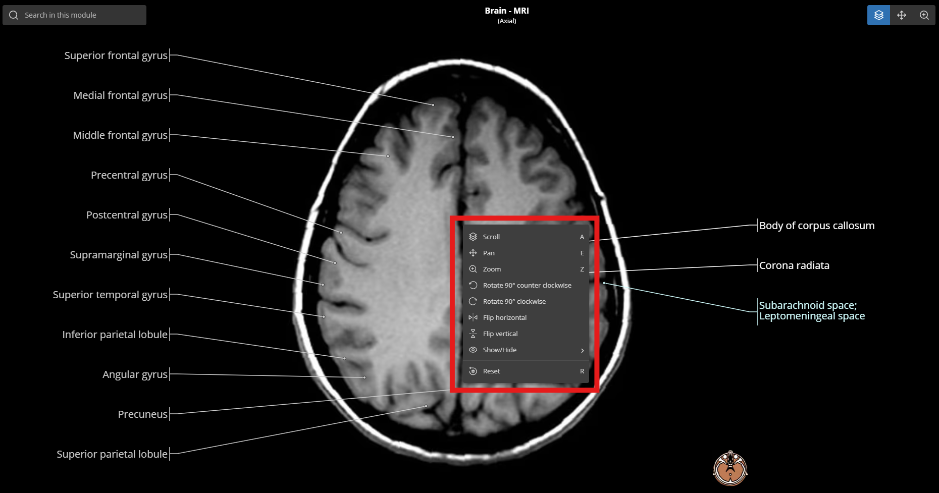 First steps with e-Anatomy – IMAIOS Help Center