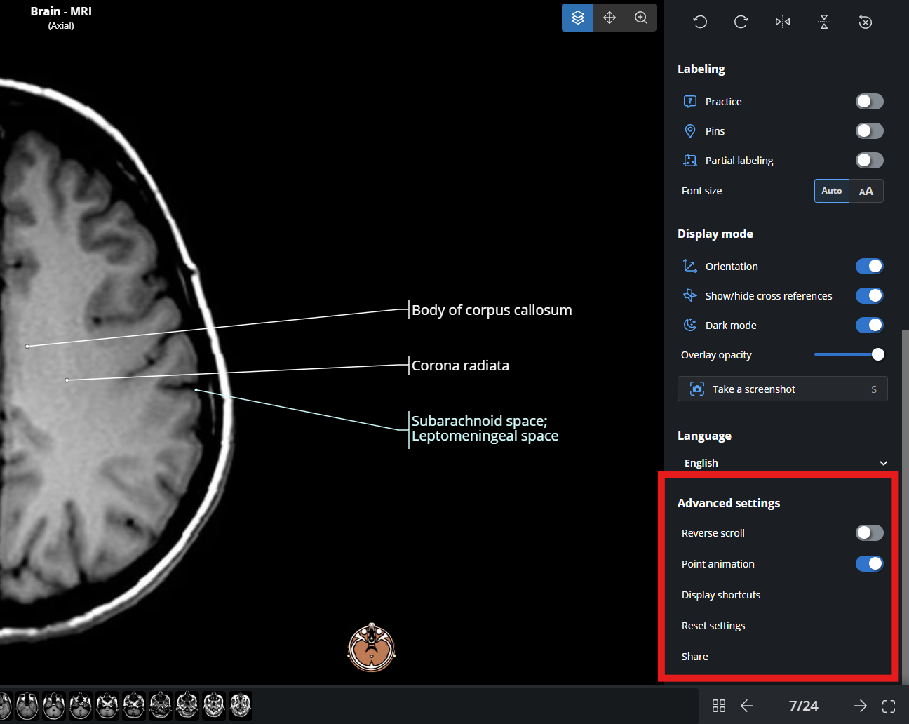 First steps with e-Anatomy – IMAIOS Help Center